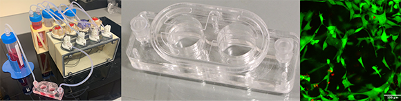 MOON - in vitro endometriosis microphyisiological system | HEPIA